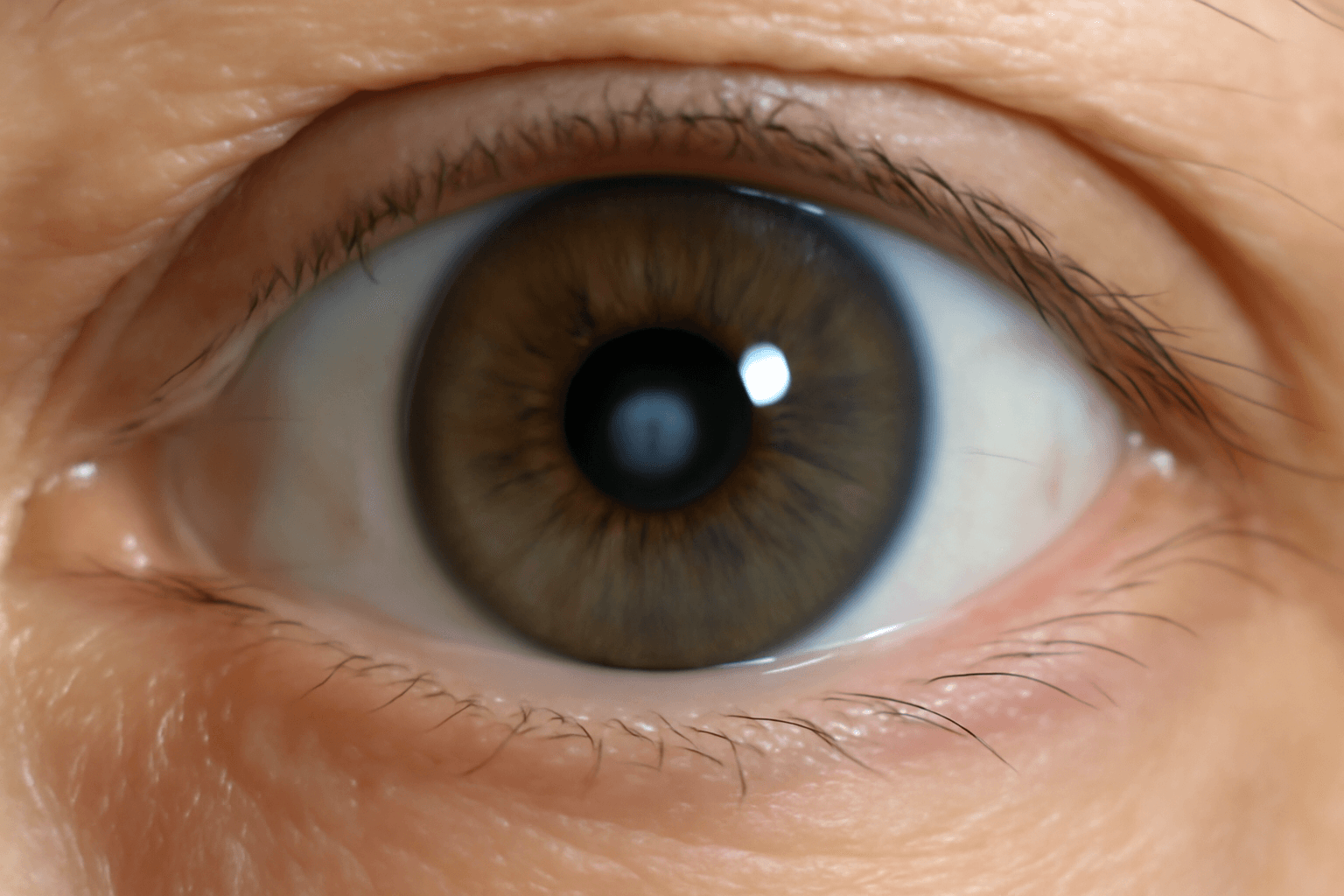 Blue Dot Cataract: Symptoms, Causes, & Treatment | Dr Agarwals