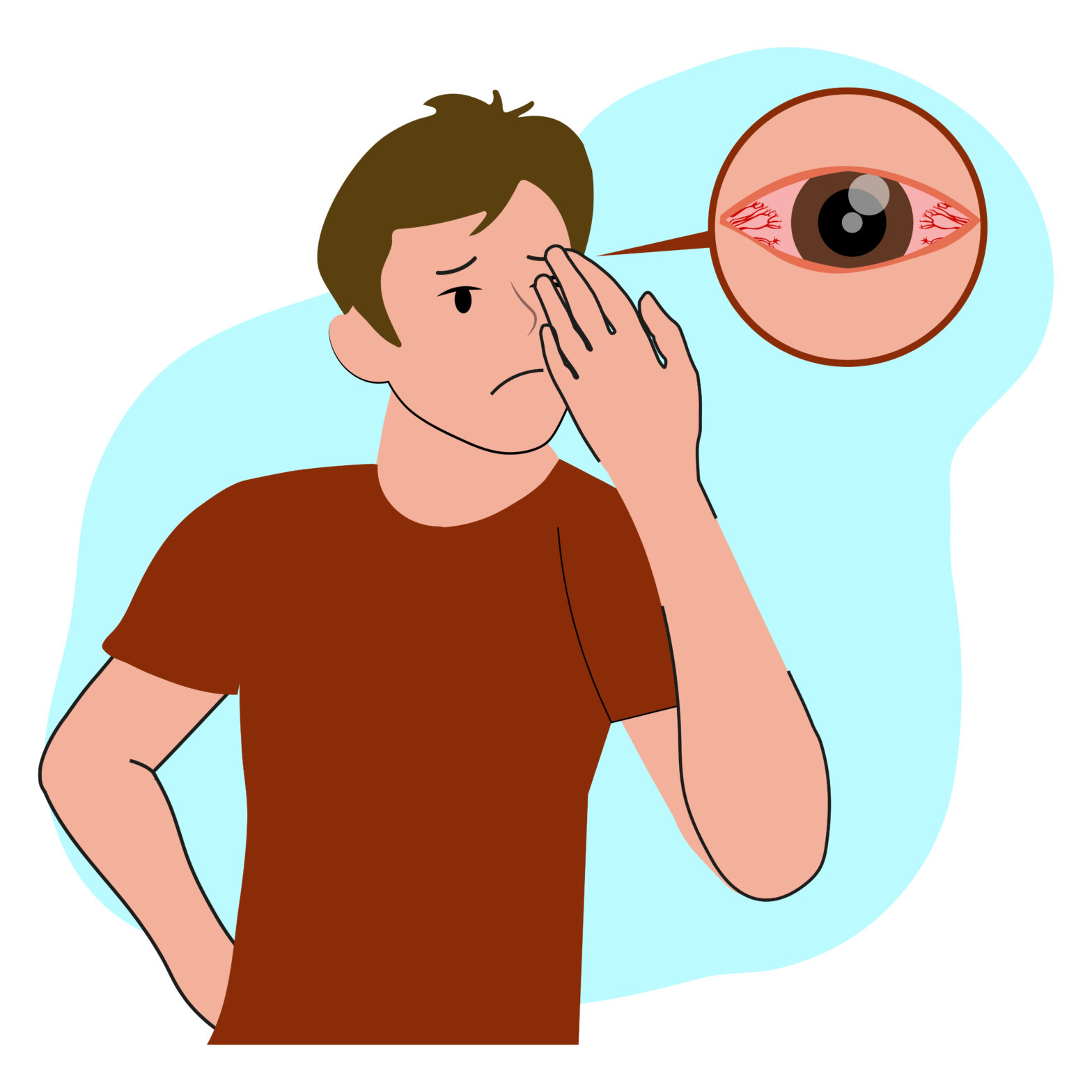 Eye Flu: Symptoms, Causes & Treatment Guide