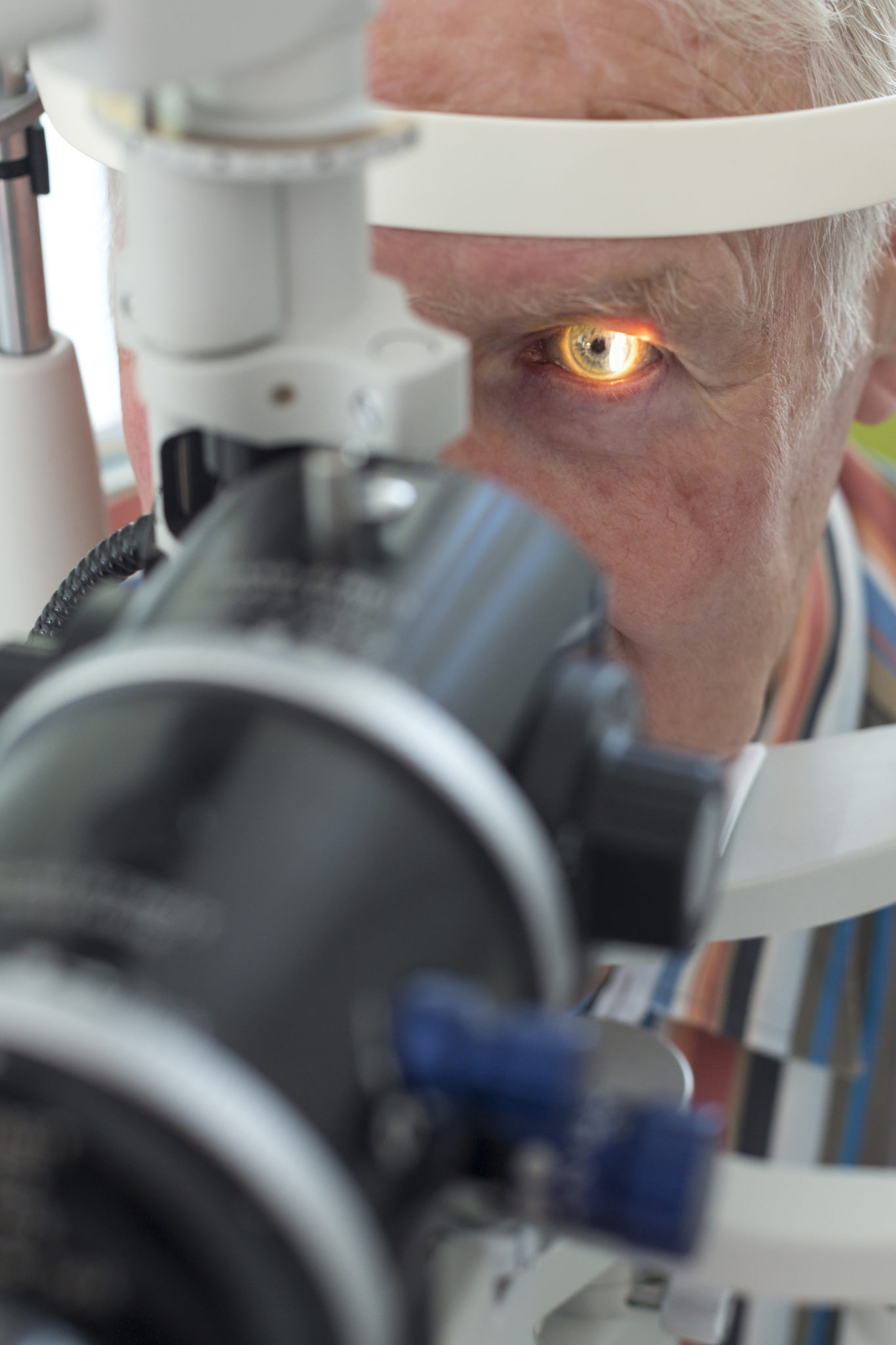 Mature Cataract: Causes, Symptoms & Treatment Options