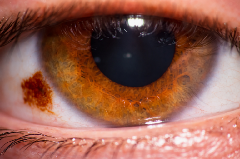 Vision Test: Meaning, Types, Eye Exam Process & Importance