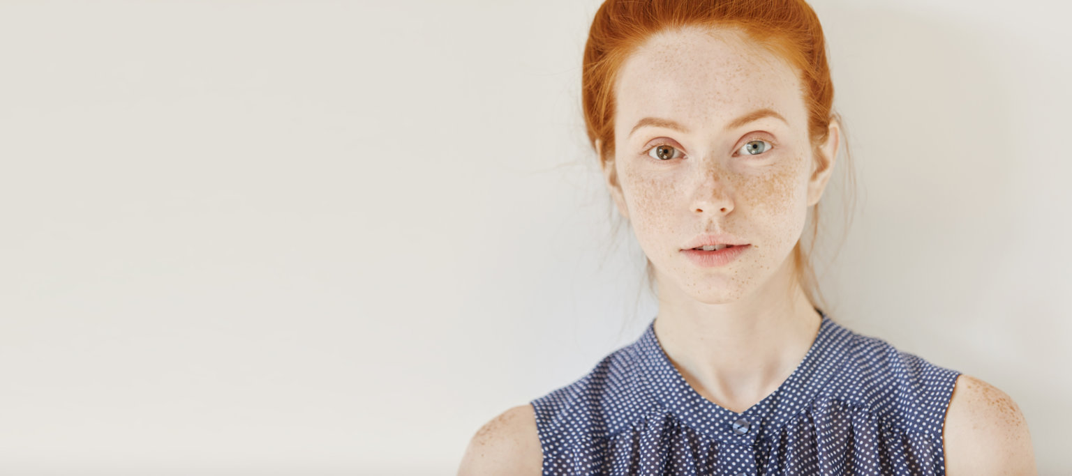 Heterochromia Explained: Why Do Some People Have Two Different Eye Colours?